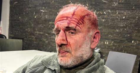 კობა ხაბაზს ფიზიკურად გაუსწორდნენ კოალიცია ცვლილებისთვის ოფისში