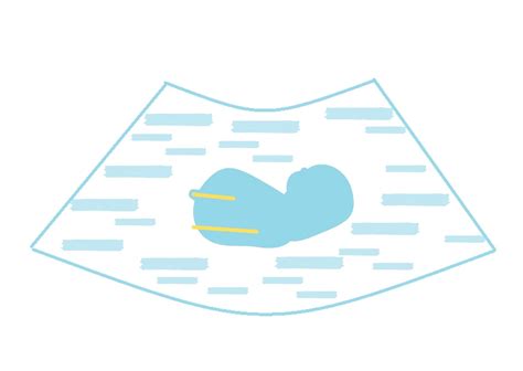 Nub Theory What Is It And How It Predicts Your Babys Sex At Weeks GoodtoKnow