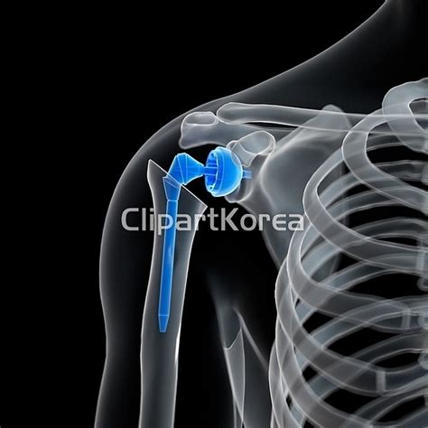 해외작가포토 클립아트코리아 통로이미지주