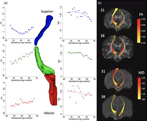 Withintract Analysis Of CST Heterogeneity In Development Of The CST Download Scientific