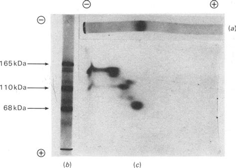 Location Of The Dehydroquinase Active Sites On Fragments Download Scientific Diagram