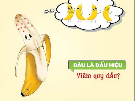 địa Chỉ Chữa Mụn Rộp Sinh Dục Uy Tín Tại Bạc Liêu Phongkha Flickr