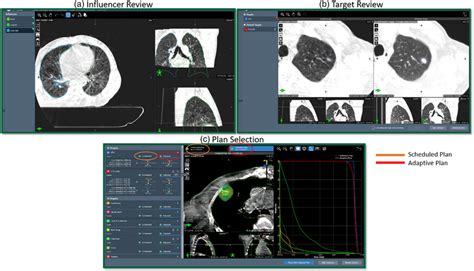 The Adaptive Portion Of The Treatment Delivery Workflow Modules A