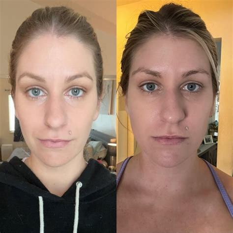 Started The Year Off With A Torn Left Titty And Ending The Year With A