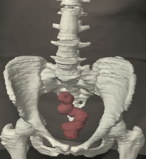 Pelvis And Abdomen Radiology Key