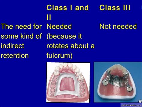 Lec 2principles And Essential Of Rpd Design Pptx د رضوان Muhadharaty