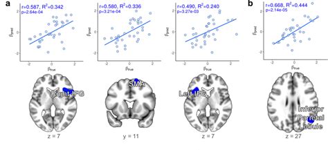 Mapping Fnirs To Fmri With Neural Data Augmentation And Machine Learning Models Paper And Code
