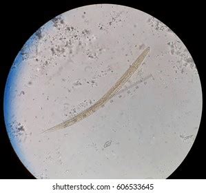 Aspergillus Niger Under Microscope 10x Subjective Stock Photo