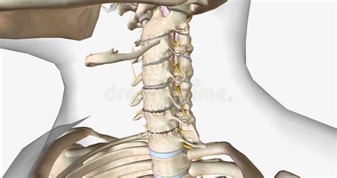 Cervical Disc Degeneration Or Cervical Disc Disease Is A Process That