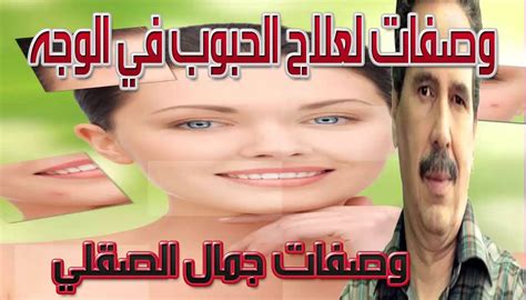 وصفات لعلاج الحبوب في الوجه وازالة حب شباب مضمونة مع جمال صقلي علاج