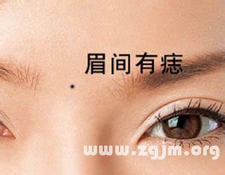 天仓痣图片欣赏 天仓有痣图片 天庭有痣图片 大山谷图库