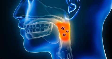Novel Immunotherapy Approach Benefits High Risk Hpv Positive Head And