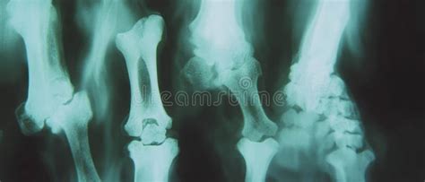 X Ray Texture Showing Grainy And Speckled Details Of Skeletal Structure Stock Image Image Of