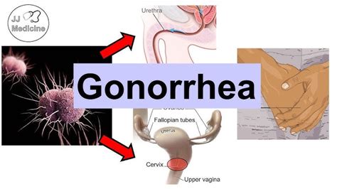 Gonorrhea Bacteria Structure