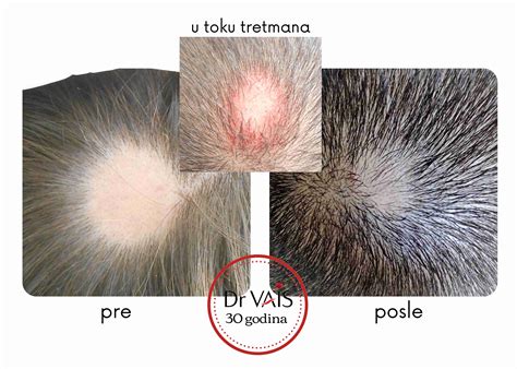 Dr Vais Estetski Centar