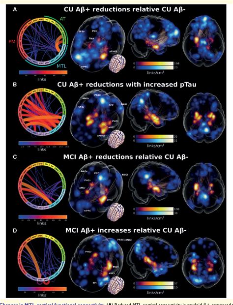 Figure 3 From Medial Temporal Lobe Connectivity And Its Associations With Cognition In Early