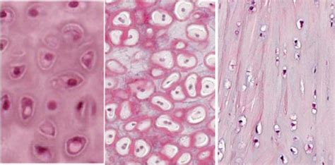 Histo Ct Cartilage Bone Flashcards Quizlet