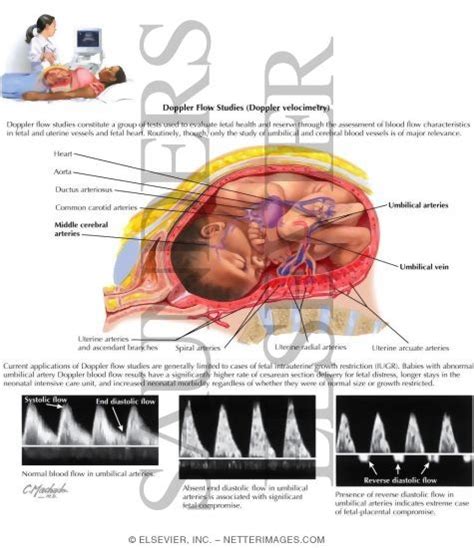 Doppler Velocimetry Meddic