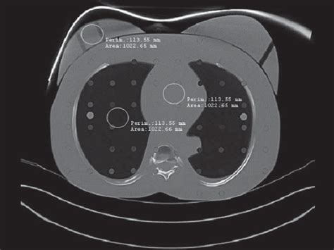 A CT Scan Image Of The Phantom With Mm Mm Circles Indicating Download Scientific