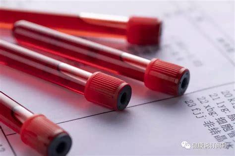 胆红素高的原因胆红素高怎么调理 说明书网