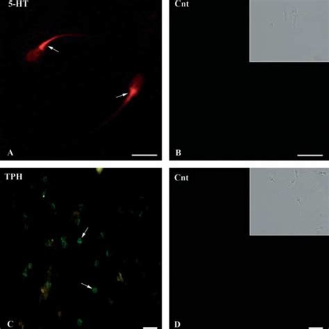 Tryptophan Hydroxylase Activity Monitored Through The Production Of Download Scientific Diagram
