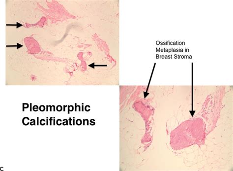 A Pleomorphic Heterogeneous Radiology Key