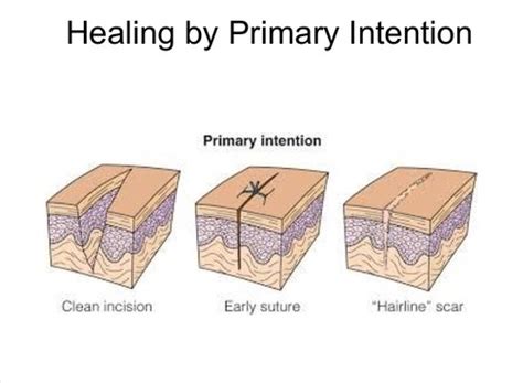 B260 Fundamentals Immunity Inflammation And Infection Flashcards Quizlet