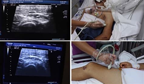 B Ultrasonographic Measurements Download Scientific Diagram