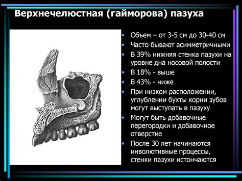 Череп Околоносовые пазухи Контрфорсы Строение варианты и аномалии
