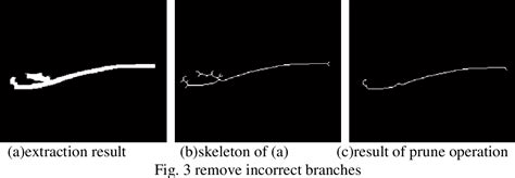 Figure 1 From Automatic Elongated Object Segmentation In Ct Image Using