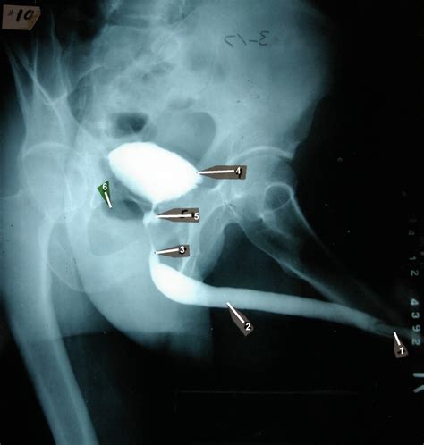 Diagram Of Urethrogram Quizlet