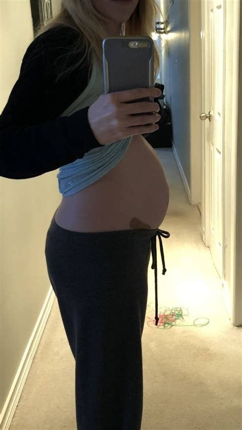 26 Pictures People With Endometriosis Want You To See Artofit