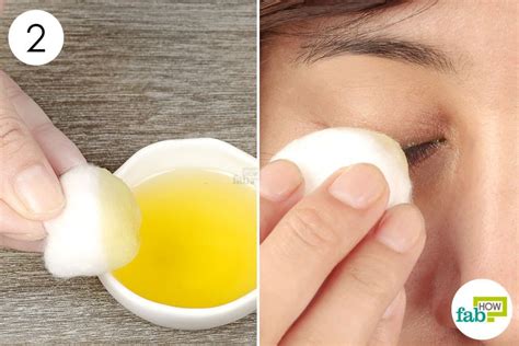 Eyelid Infection Pictures Causes Treatment Remedies