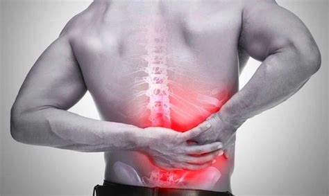 ¿cómo Se Cura Una Hernia Discal