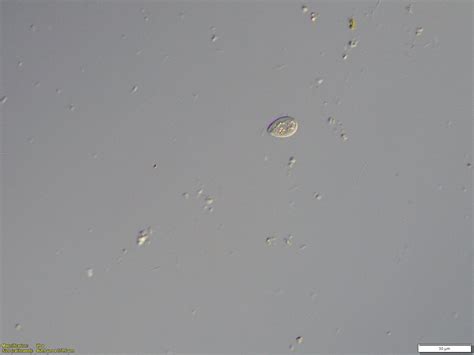 Algae Processed Blackboxes Object Detection Dataset By Stuff