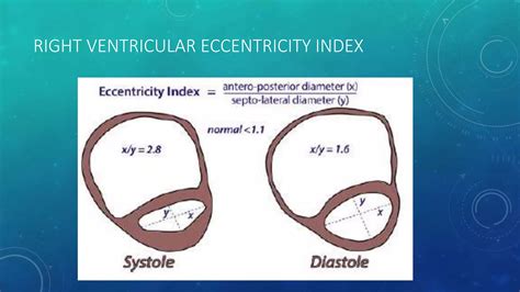 Assessment Of Rv Function Pptx