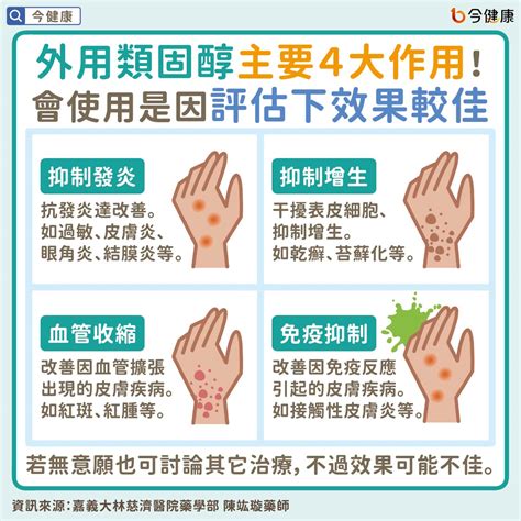 外用類固醇5類型差在哪？如何安全使用、防副作用？藥師詳解！
