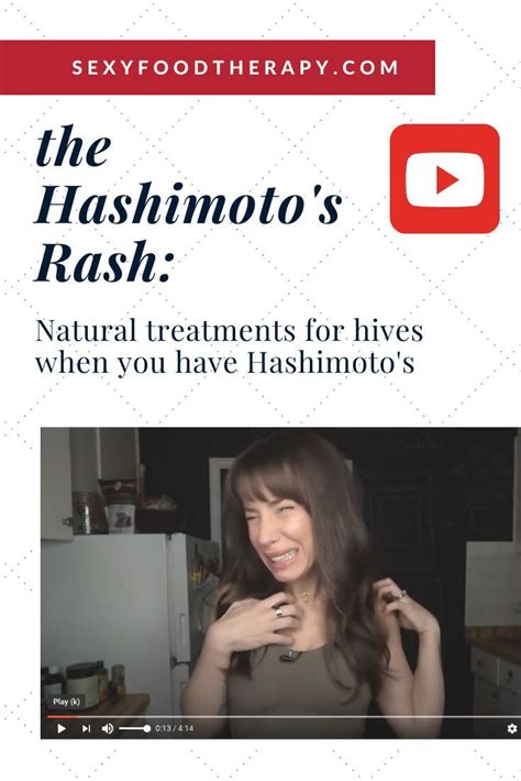 The Hashimoto S Rash Why Skin Issues Are Common And What To Do About It Artofit