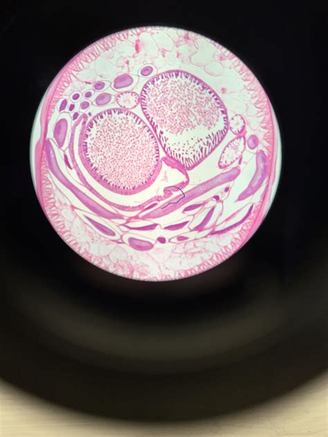 Diagram Of Ascaris Lumbricoides Female Cs Quizlet