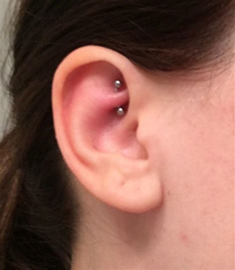 Please Help I Hit My Rook Piercing Somehow After Having It Healed For