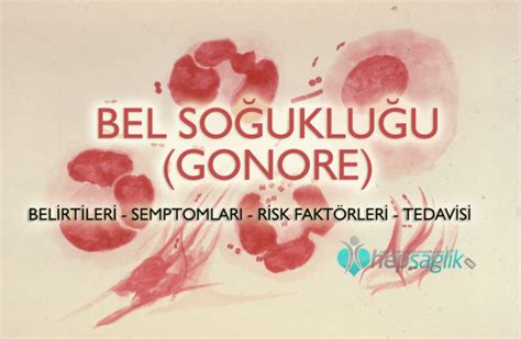 Bel Soğukluğu Nedir Belirtileri Semptomları Ve Tedavi Yöntemleri