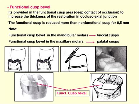 Functional Cusp Of Mandibular Teeth At Ella Hogarth Blog