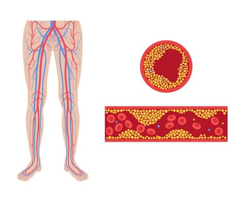 Peripheral Arterial And Venous Noble Imaging And Diagnostics