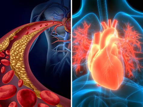 8 Simple Home Remedies Natural Ways To Improve Your Cholesterol Levels