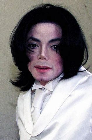 Michael Jackson Nose Collapse