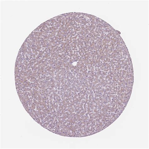 Tissue Expression Of Apoe Staining In Liver The Human Protein Atlas