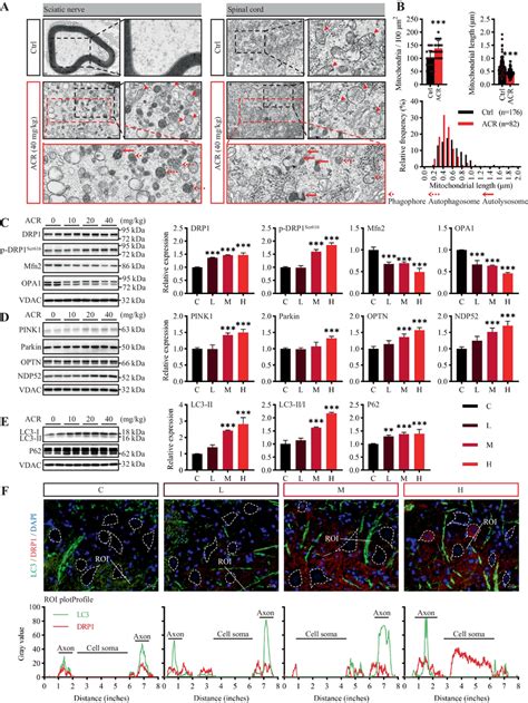Mitochondrial Dynamics Are Disturbed And Mitophagy Related Proteins