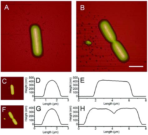 morphology and section analysis of b subtilis a and b are