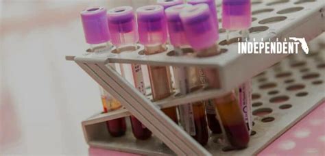 The Most Common Types Of Blood Tests Florida Independent
