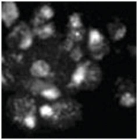 Mad1 Rabbit Polyclonal Antibody Abnova 100μl Unlabeled Antibodies